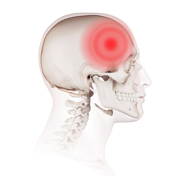 Migrenowe bóle głowy - Solvano. Metoda przyspieszonej rehabilitacji
